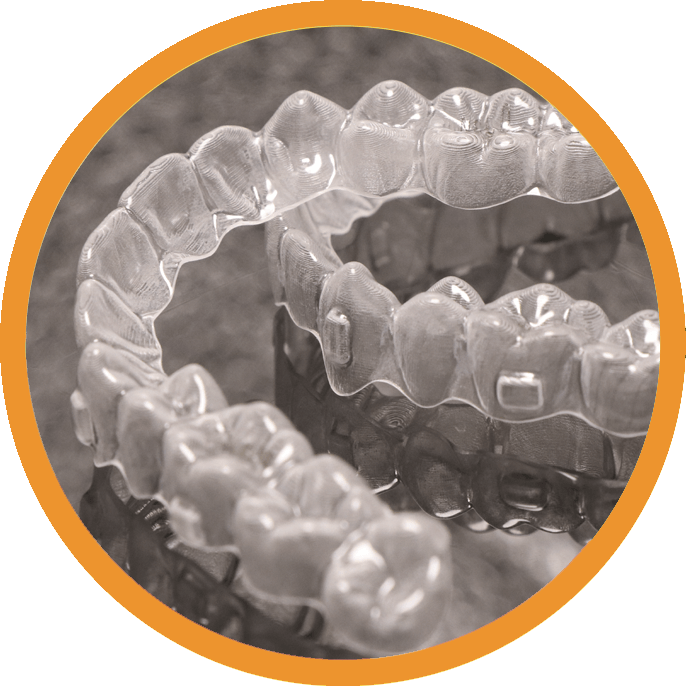 Micro correction retainers ********** braces and traditional braces for ...